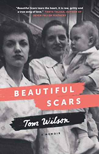 Beautiful Scars: A Memoir by Tom Wilson - Book Outlet